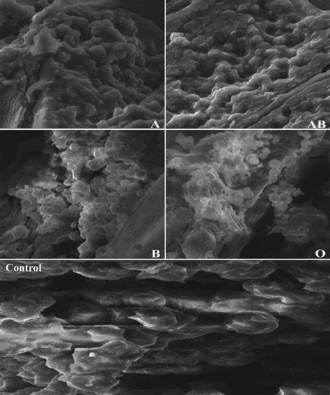 Scanning Electron Microscope Results Of The Effect Of Different Blood