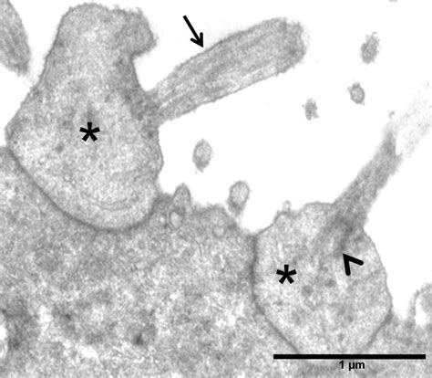 Olfactory Knob Of Ciliated Olfactory Sensory Receptor Neuron In