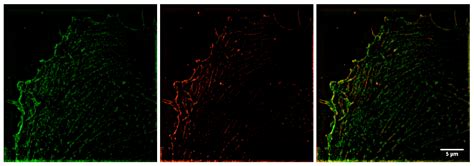 Colocalization Analysis Of Cytoplasmic Actin Isoforms Distribution In