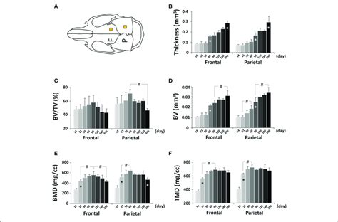 µct Analysis Of Bone Parameters Of Cranial Vault Bones Frontal And