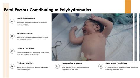 Polyhydramnios Risk Factors Ppt Sample Acp Ppt Sample