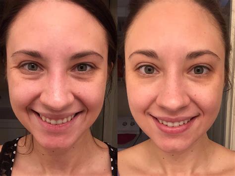 People Say This 20 Vitamin C Serum Completely Cleared Up Their Skin