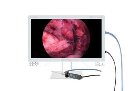 1080p Hd Integrated Endoscopic Camera System With Imaging Processor For Hospital Use