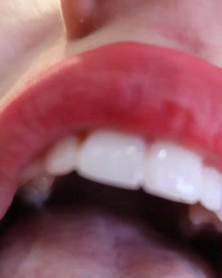 Colleen Ballinger Nude Porn Pictures XXX Photos Sex Images 4057460 PICTOA