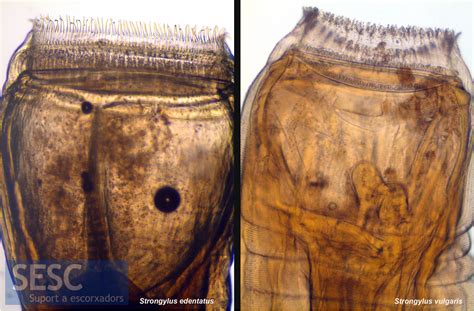 Strongylus Vulgaris Adult