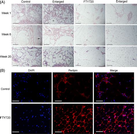 Fty720 Improved Fat Graft Structure Integrity A Hematoxylineosin