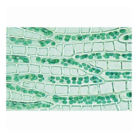 3b Scientific Bryophyta Liverworts And Mosses Slide Set 15 Buy