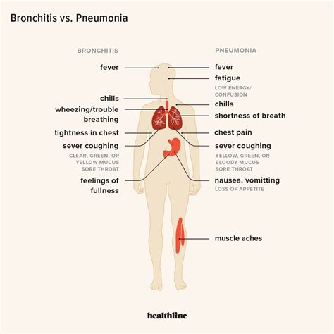 Bronchitis Vs Pneumonia How To Tell Artofit