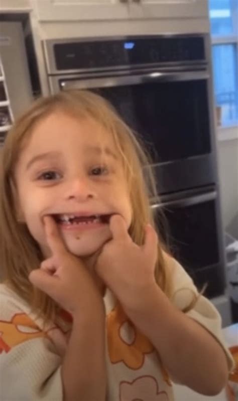 This Is Her Poor Bite Her Top And Bottom Teeth In The Back Are Touching Raliandjohnjamesagain