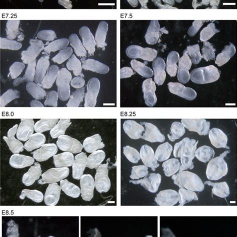 A Single Cell Molecular Map Of Mouse Gastrulation And Early Organogenesis Request Pdf
