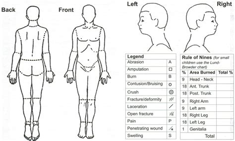 Winding Spiral Case Atls Primary And Secondary Surveys In Brief
