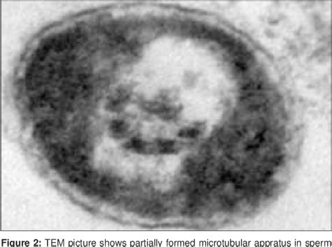 Figure 1 From Mitochondrial Dna Mutations In Etiopathogenesis Of Male
