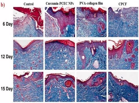 A Synthesis Steps Of A Composite Film Of Cpcf Based On Curcumin Pcec