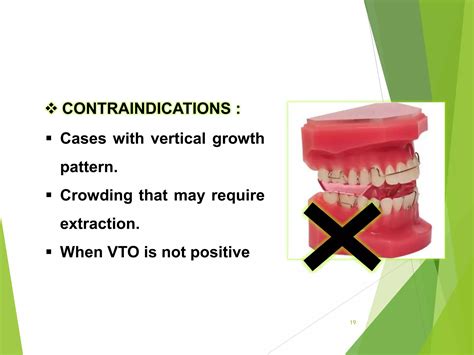 Twin Block Appliance Pptx