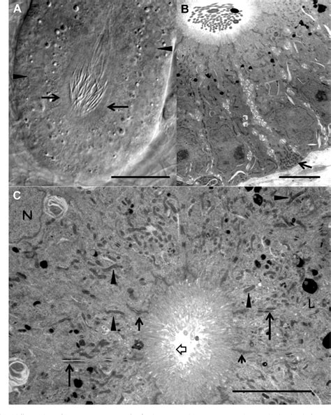 Figure 1 From Apical Blebs On Sperm Storage Tubule Epithelial Cell
