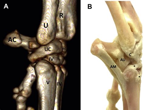 Canine Carpal Injuries Veterinary Clinics Small Animal Practice