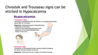 Hypocalcemia And Hypercalcemia Presentationpdf