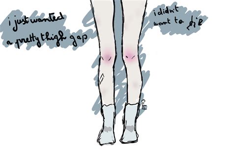 ♡its Safe Here♡ — I Just Wanted A Pretty Thigh Gap I Didnt Want To