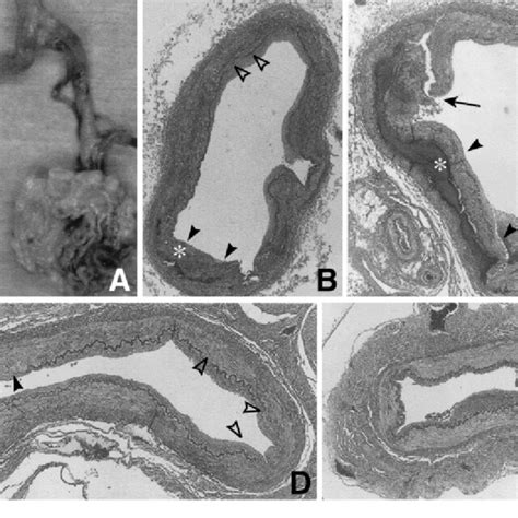 A 55 Year Old Man A There Were No Gross Abnormalities In The