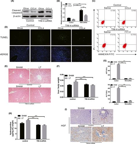 Tim‐4 In Kcs Mediates Mitophagy Via Akt1 During Liver Fibrosis A B