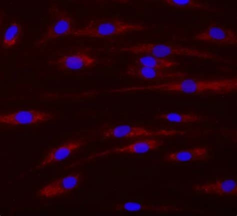 Tmrm Assay Kit Mitochondrial Membrane Potential Ab228569 Abcam