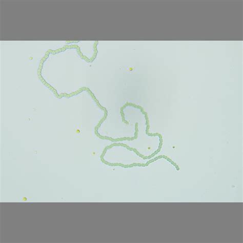 Hunhe Object Detection Dataset By Algae