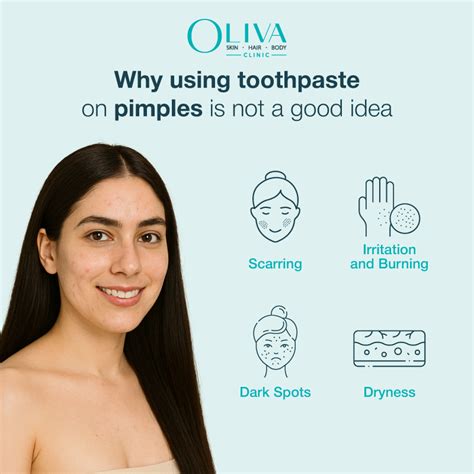 Toothpaste On Pimple Does It Work Or Cause Harm Dermatologist Explains