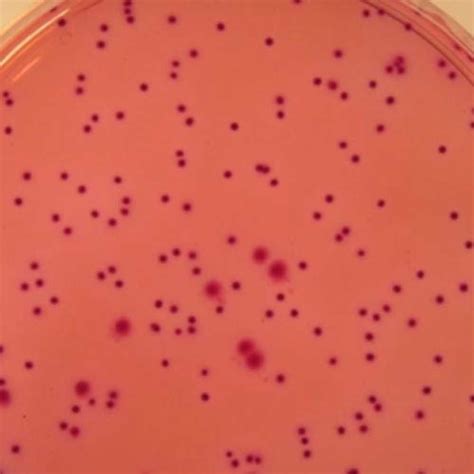 Lasec Neogen Violet Red Bile Agar With Mug Vrba Mug 500g Ncm0064