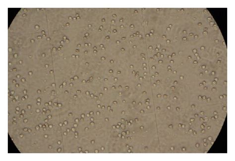 Nucleated Cell Counts Monocytes Were Observed To Be Numerous Uniform Download Scientific