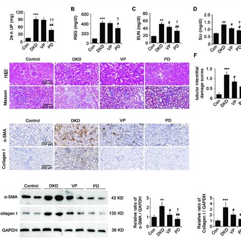 Pd Inhibits Pathological Matrix Stiffness Induced Yap Expression In