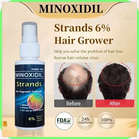 Minoxidil I Hair{vs Grower Uq Original Jl 60ml X Minoxidil V Strands W