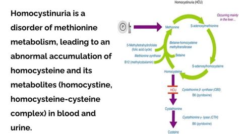Homocystinuria Ppt