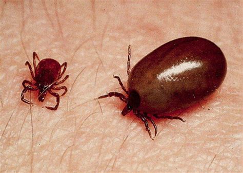 Scrub Typhus Disease Symptoms Diagnosis And Treatment Vims