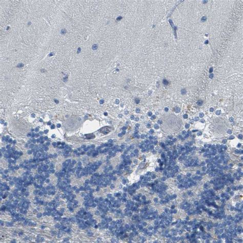 Rabbit Polyclonal Anti Cyp2c8 Antibody Buy For Research Highly