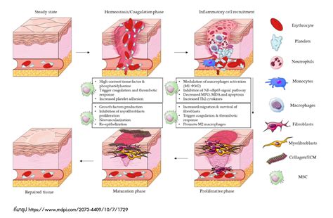 ปัจจัยต่างๆที่ส่งผลต่อกระบวนการการหายของบาดแผล Best Equipment Center