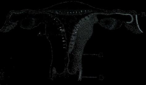 Unlabeled Diagram Of The Female Reproductive System