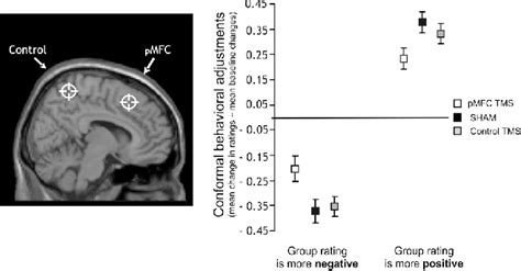 Figure 1 From Downregulation Of The Posterior Medial Frontal Cortex Figure 1 From Downregulation Of The Posterior Medial Frontal Cortex