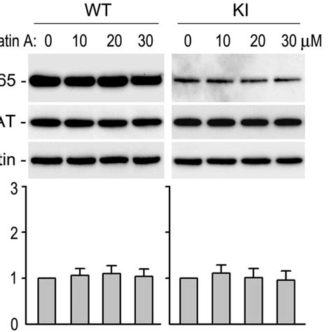 Ubiquitination Dependent Proteasomal Degradation Of R91w Rpe65 In Mouse