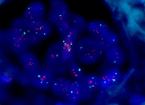 Tissue Fixation Protocol Glint Lab Website