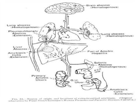Amebiasis And Giardiasis In General Population Ppt