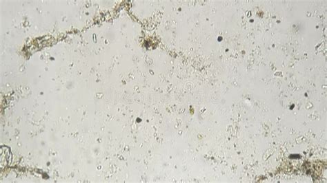 Eggs Of Taenia Solium Whole Mount Magnified Under Microscope 100x Filmed With Cross Light Stock