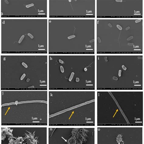 Scanning Electron Microscope Images Showing Morphological Adaptation Of Download Scientific