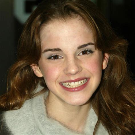 Emma Watson Beauty Evolution Amica