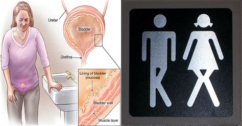 These Are The Deadly Dangers Of Holding Your Pee A Must Read