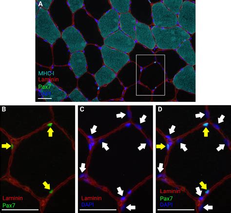 Myonuclear Addition Is Associated With Sex Specific Fiber Hypertrophy