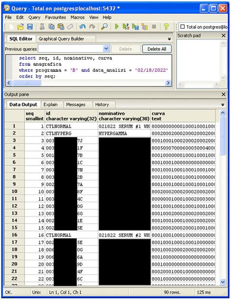 Screen Shot Showing The Retrieval Of Densitometric Curve Data For 1