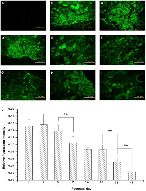 Immunohistochemical Staining Of Trpc6 Showed The Expression Of Trpc6 In