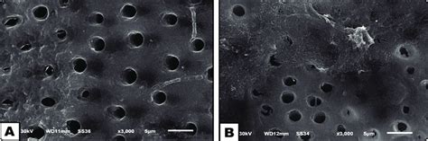 Scanning Electron Microscopy For Conditioned Dentin Scaffold With Edta Download Scientific