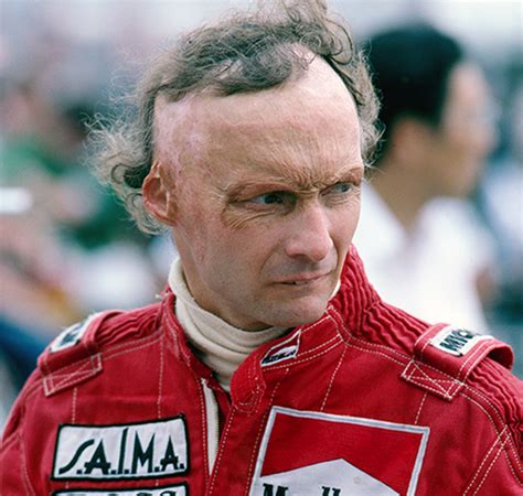 Niki Lauda Paralizó La F1 Envuelto En Llama En El Gp De Alemania En 1976