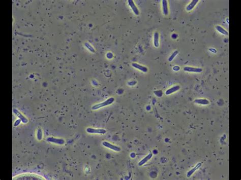 Lactobacillus Under Microscope